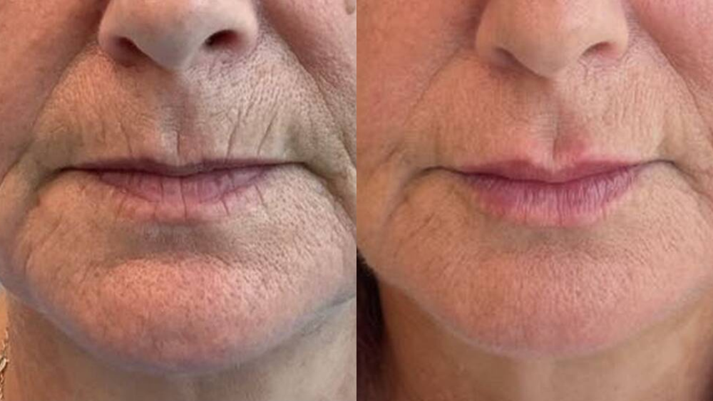 Calcium Volume Multi Balm – Lovera