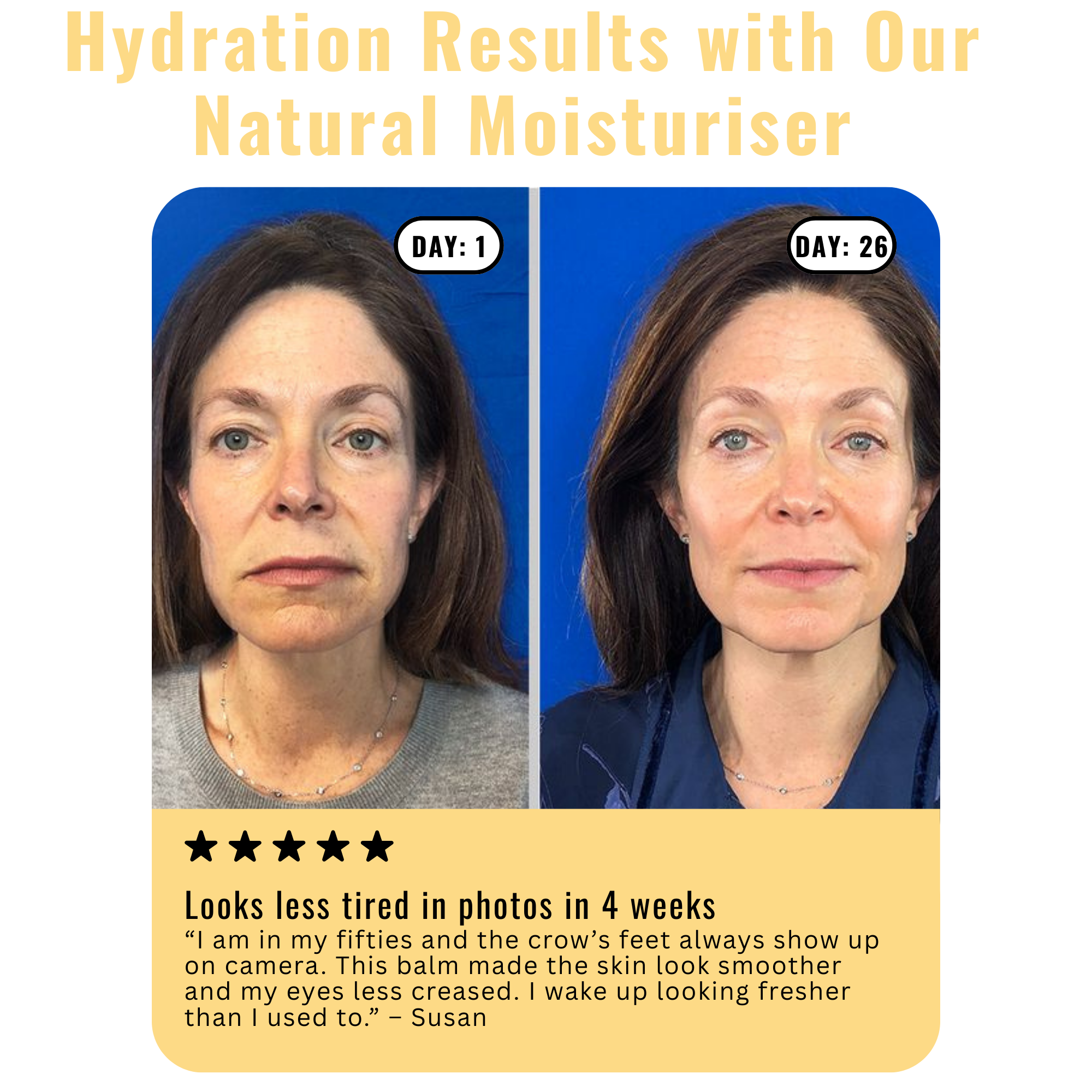 Day & Night Everything Moisturising Balm – Lovera